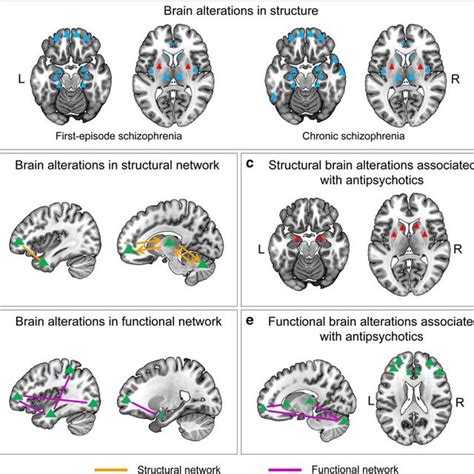 Brain Maps Showing The Common Structural And Functional Brain Download Scientific Diagram