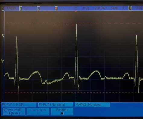 Electrocardiogram Ecg Circuit Design 6 Steps Instructables
