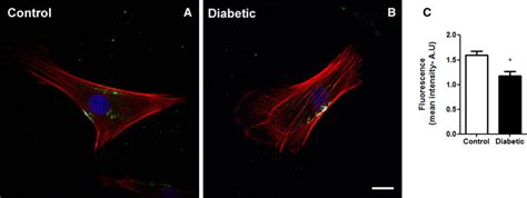The Pericellular Fibronectin Matrix Is Reduced In Fibroblasts Obtained Download Scientific