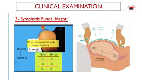 Estimation Of Gestational Age Pdf Pregnancy Reproductive Health