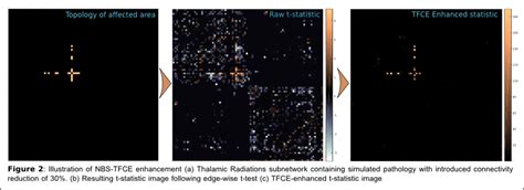 Illustrates The Tfce Enhancement In Practice Showcasing The