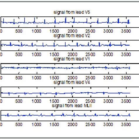 Basic Framework Of Arrhythmia Monitoring Download Scientific Diagram