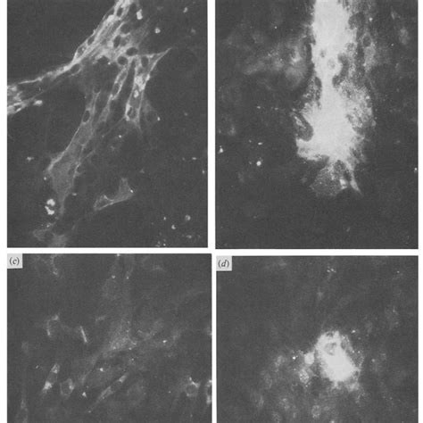 Immunofluorescence Patterns Of Embryonic Fibroblast Cell Cultures