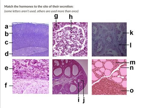 Solved 1 Acth 2 Adh Production 3 Adh Secretion 4 Aldosterone
