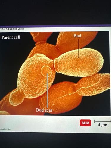 Ch 12 The Eukaryotes Fungi Algae Protozoa And Helminths Flashcards Quizlet