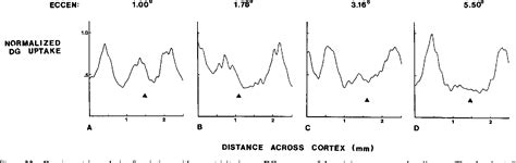 Figure 22 From Functional Anatomy Of Macaque Striate Cortex Ii Retinotopic Organization