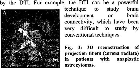 Figure 1 From Data Analysis Techniques And Applications Of Diffusion Tensor Imaging Semantic