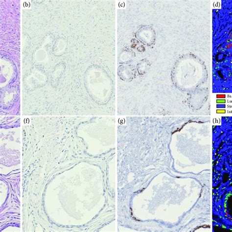 Virtual IHC And 4 Channel Molecular Representation Of A D Crowded Download Scientific Diagram