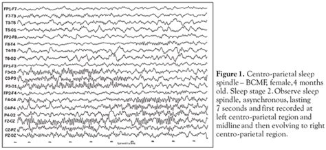 Sleep Spindle Eeg Frequency