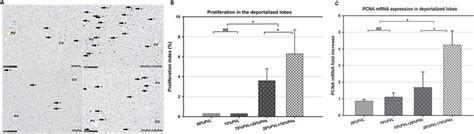 proliferation index pi and brdu staining of the deportalized lobes