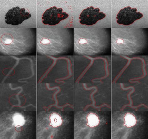 Real Medical Images With Different Inhomogeneous Intensity Levels