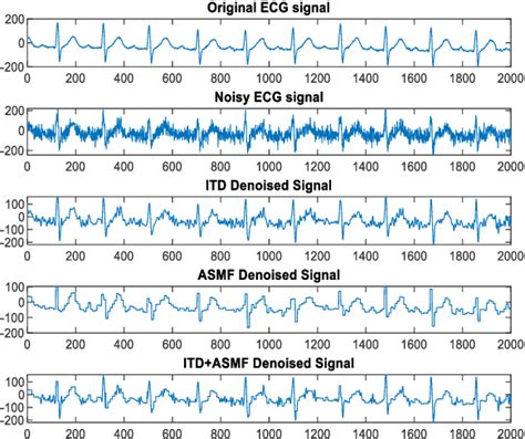 figure 6 from ecg denoising methodology using intrinsic time scale