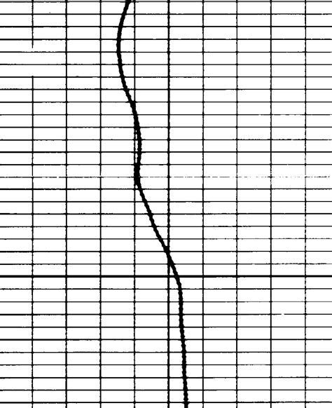 Curve Extraction Computer Vision Dataset By Welllog