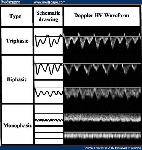 Liv564073fig1 500×528 Board Exam Exam Publishing