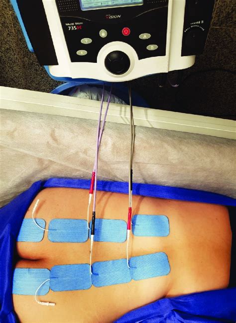 Electrode Placement Download Scientific Diagram