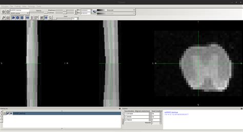 poor segmentation for sct deepseg gray matter mouse model affine