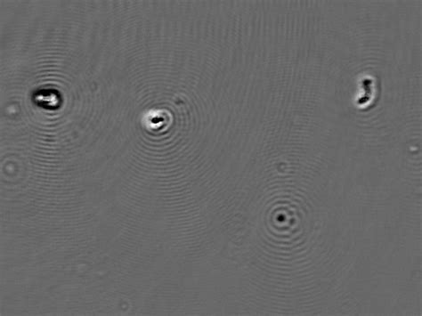 Bacteria Lager Set2 Object Detection Dataset By Abha Gejji