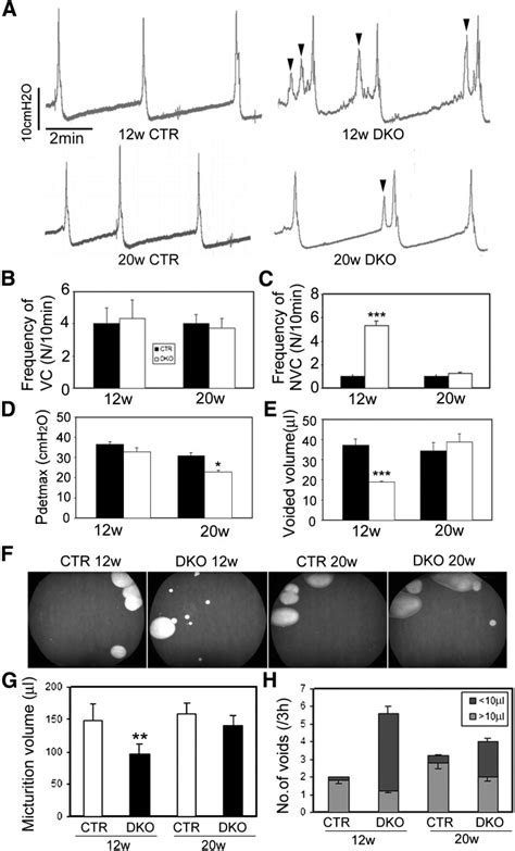 Dko Animals Exhibit Abnormal Voiding Pattern A Original Cystometric