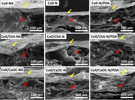 Detailed Sem Visualization Of Adhesion Between Porous Foam And