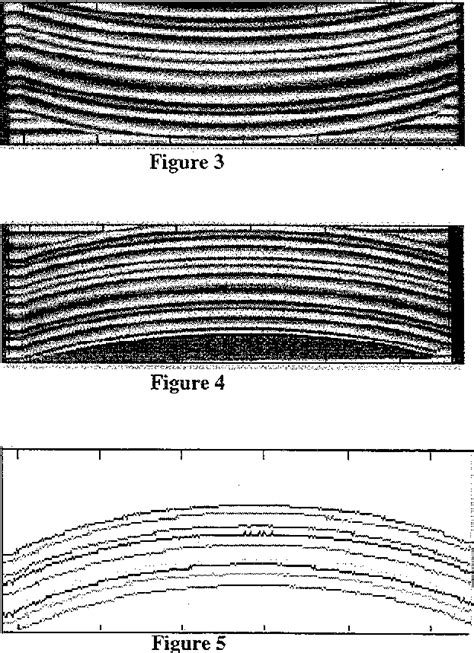 Figure 1 From An Improved Structured Light Technique For Surface