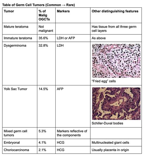 Adnexal Masses Part Iii Germ Cell Tumors — Creogs Over Coffee