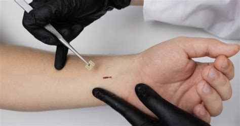 Scientists Create Biodegradable Wireless Charger For Human Implants