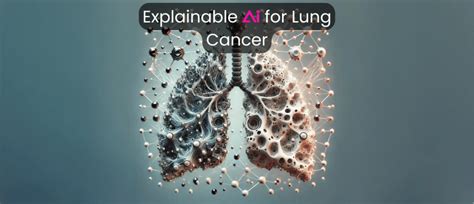 Explainable Ai For Lung Cancer Future Medicine Ai