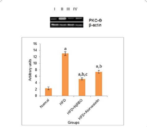 Expression analysis of protein kinase C θ PKC θ in isolated T Download Scientific Diagram