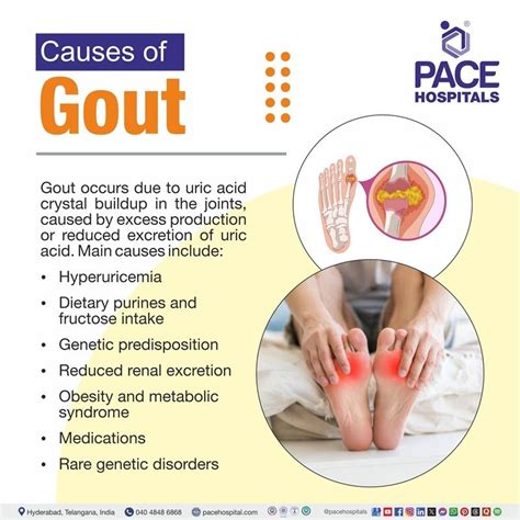 Gout Symptoms Causes Diagnosis Treatment And Prevention