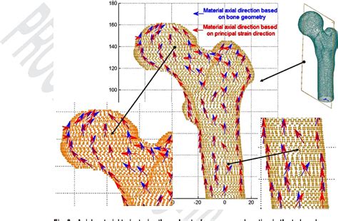 Figure 1 From Patient Specific Finite Element Analyses Of The Proximal