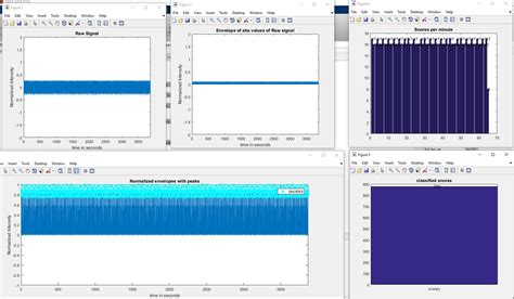 GitHub Ye Sky Detecting Breathing And Snoring With Matlab