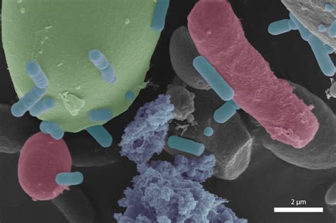 Whats In Your Sourdough Microscopic Images Reveal A Community Shaped