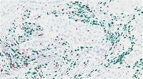 Cellcarta A Global Contract Research Organization