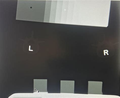 Radiographic Contrast Aluminum Plates And Varying Density And Temperature An Experiment I Did