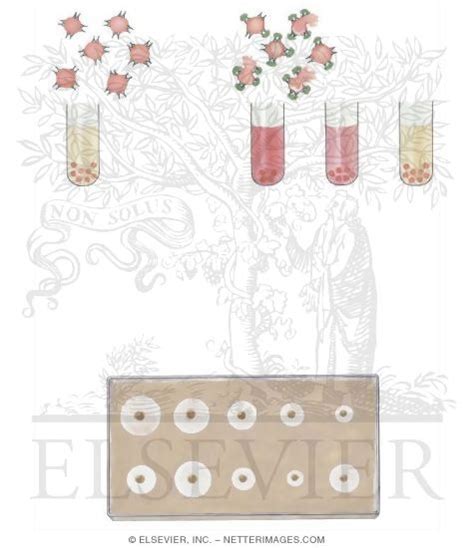 Measurement Of Complement Levels