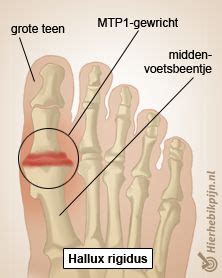 Gewrichten Van De Voet Anatomie Voet Gewricht Anatomie