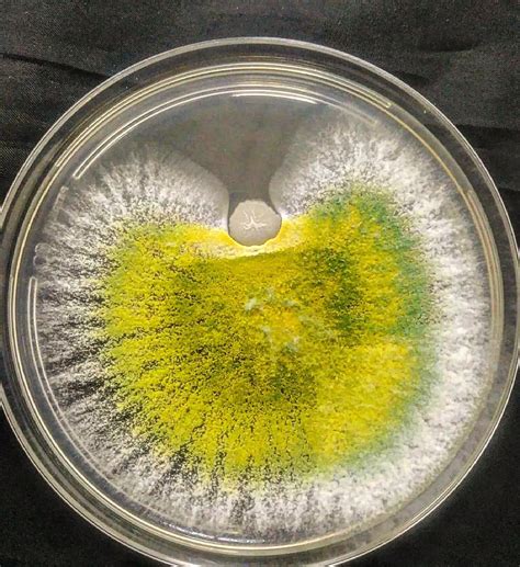 Trichoderma Harzianum 🆚 Bacillus Spp Elmicrobiologist Facebook