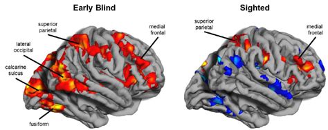 Neural Correlates Revealed By Fmri Associated With Tactile Symmetry Download Scientific