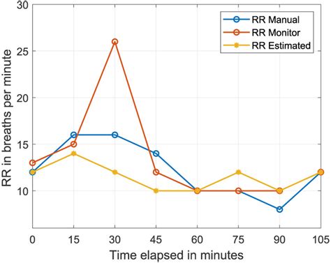 Ed Subject 2 Comparison Of The Rr Estimation With The Ground Truth