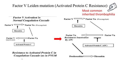 Hypercoagulable State Pptx
