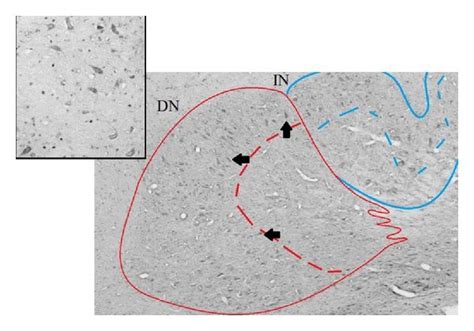 Photomicrograph 10x Magnification Showing The Distribution Of Δfosb