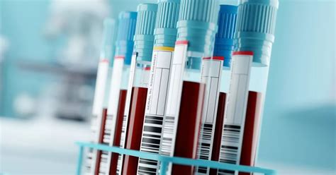 Circulating Tumor Dna Testing Ctdna Could Transform The Management Of Colorectal Cancer