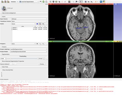 modulenotfounderror no module named vtkvmtksegmentationpython