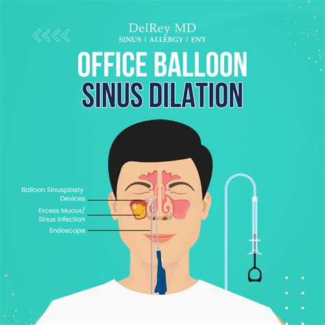 Sinusitis Treatment Marina Del Rey Rhinosinusitis Long Beach