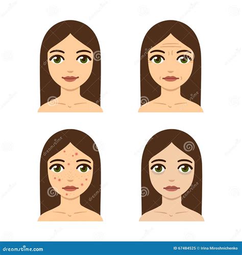 Skin Problems Illustration Cartoon Vector 67484525