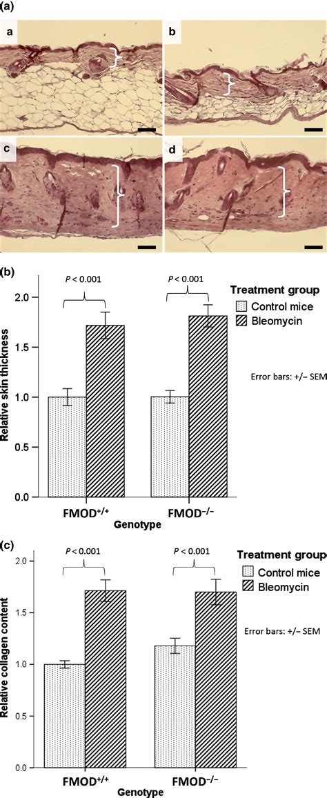Limited Impact Of Fibromodulin Deficiency On The Development Of