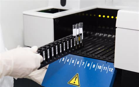 What An Immunoassay Blood Test Can Tell You Centers Urgent Care