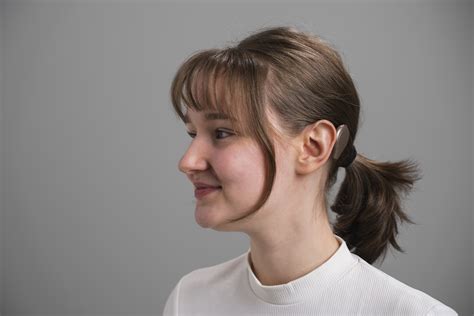 Oticon Medicals Sentio System The Smallest Transcutaneous Hearing