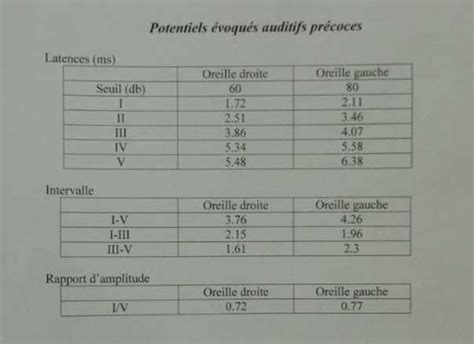 Vng Test Showing Vesibular Deficit On The Left And Prependency On The Download Scientific