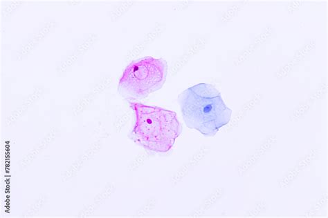 View In Microscopic Of Human Skin Cellssquamous Epithelium Cells